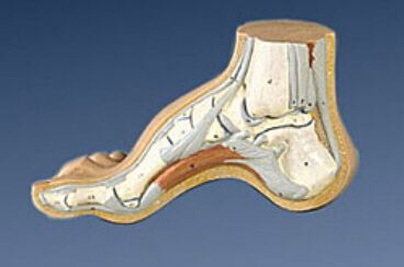 Indicaties Podotherapie